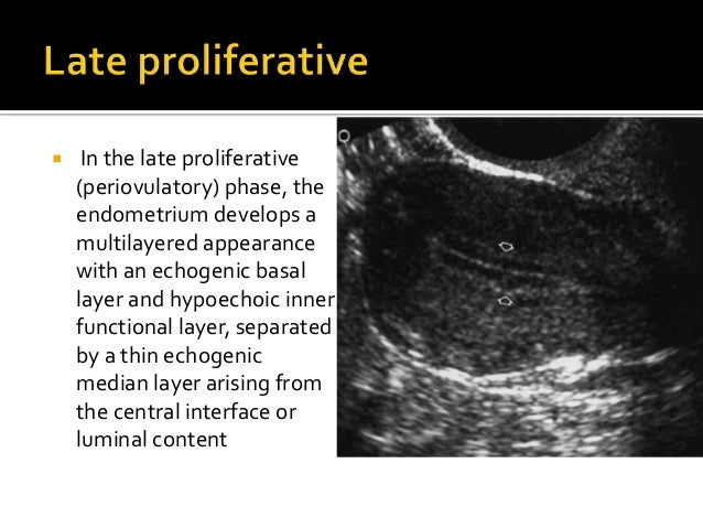 Four Stages Of Menstrual Cycle Ultrasound What Are The 4 Phases Of