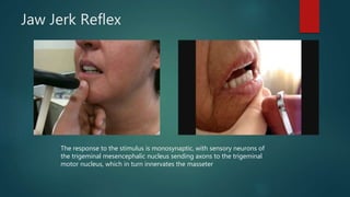 Forgotten reflex testing | PPTX
