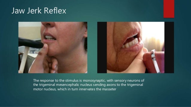 Forgotten reflex testing