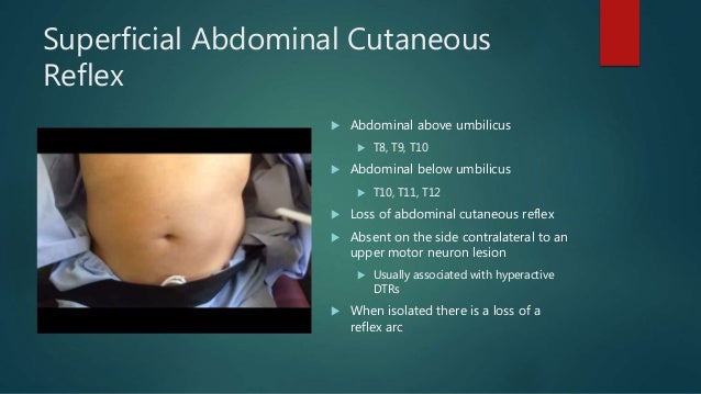 Abdominal Reflex Beevor's Sign | Epomedicine