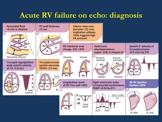 Forgotten Ventricle | PPTX
