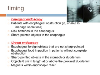 Foriegn body upper GI tract -role of endoscopy. | PPTX