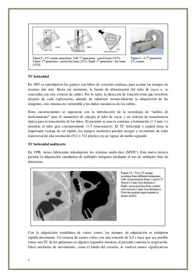 Formación de imagen en TC