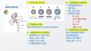 FORMACIÓN ARTROPLASTIA ENFERMERÍA CADERA MM.pptx