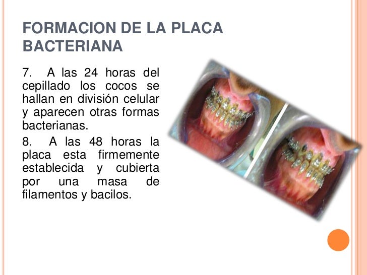 Formacion de la placa bacteriana