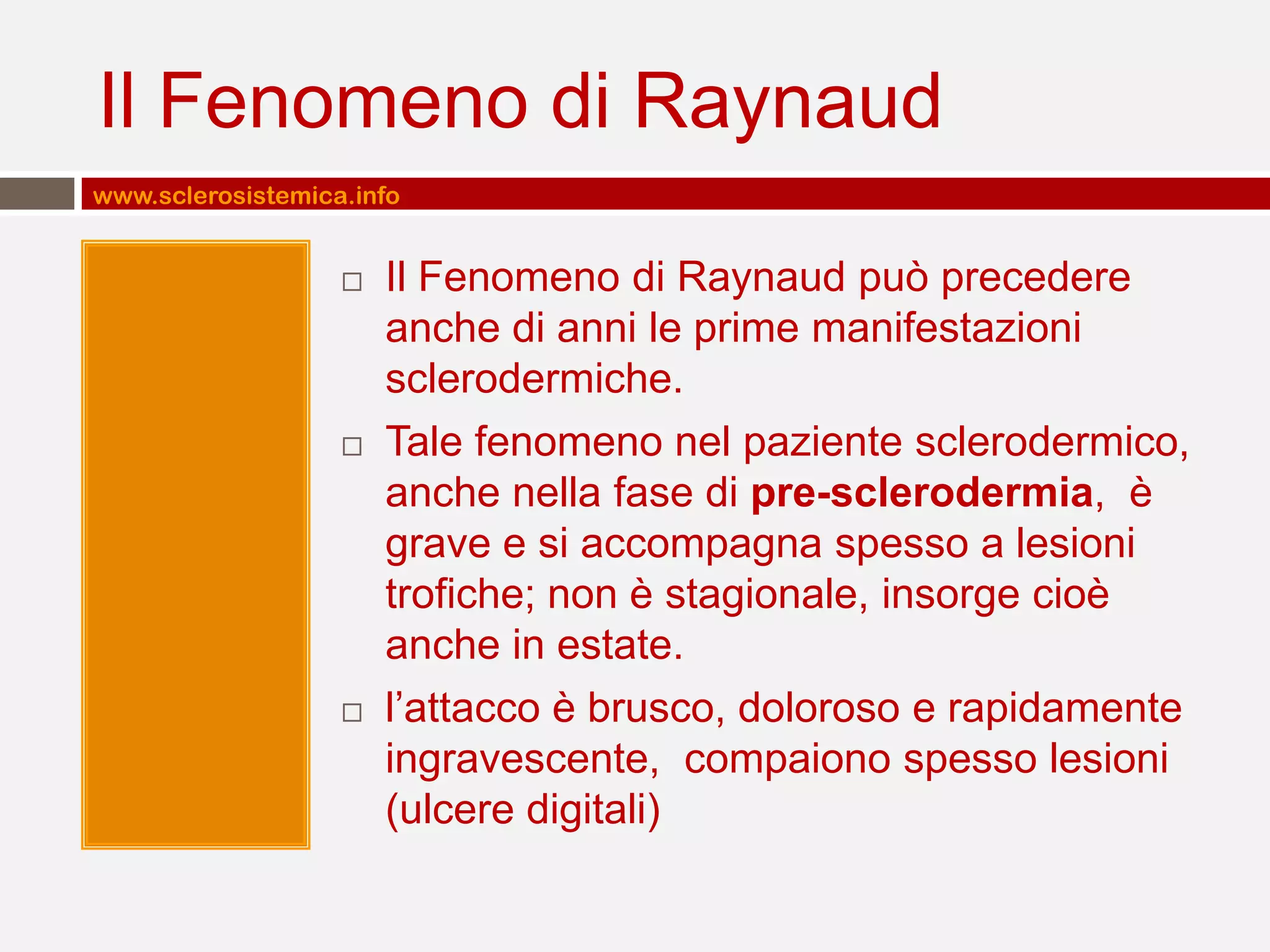 Format fenomeno di raynaud | PPT