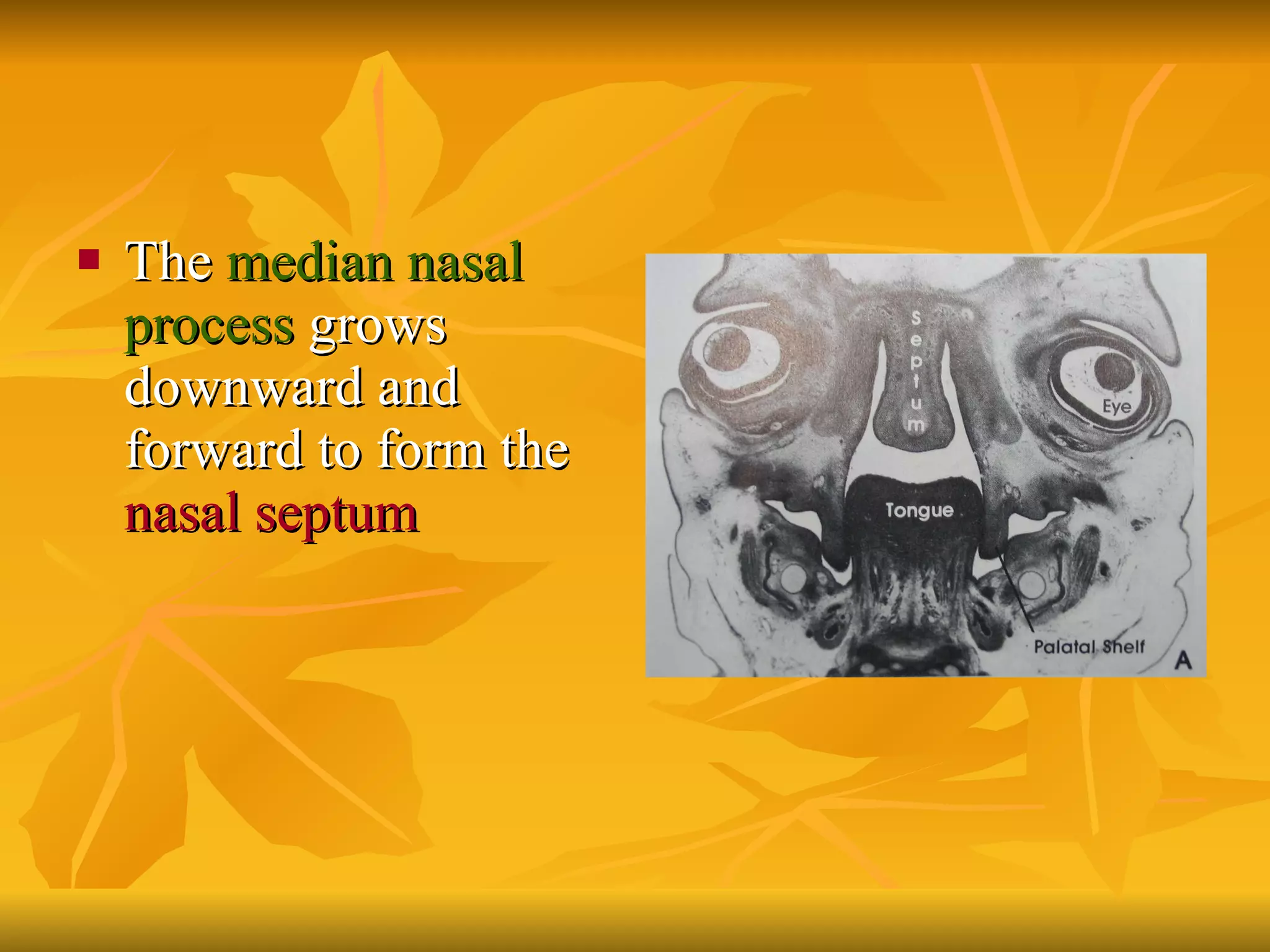 Formation of the palate | PPT