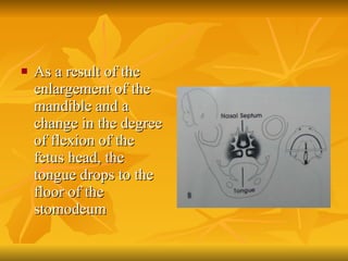 Formation of the palate | PPT