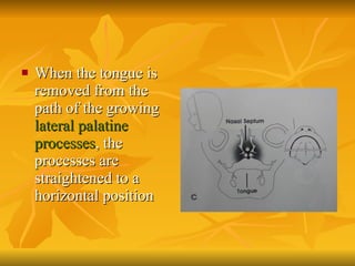 Formation of the palate | PPT