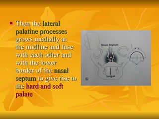 Formation of the palate | PPT