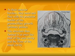 Formation of the palate | PPT