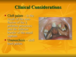 Formation of the palate | PPT