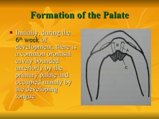 Formation of the palate | PPT