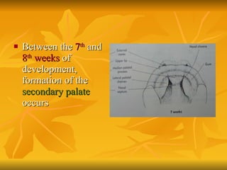 Formation of the palate | PPT