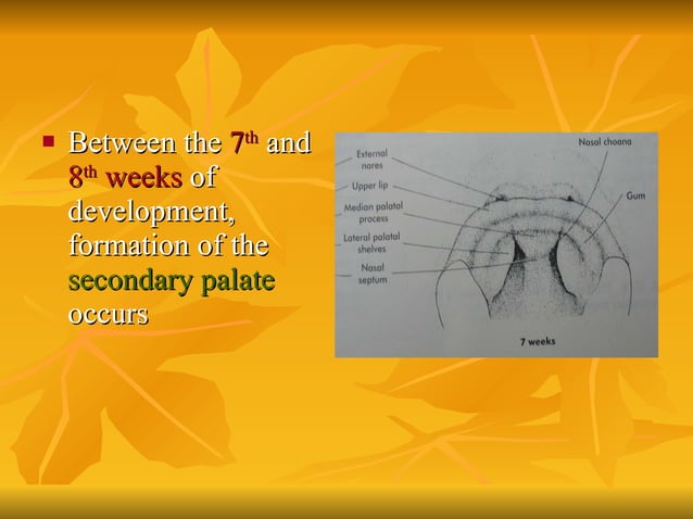Formation of the palate | PPT | Dental Health | Diseases and Conditions