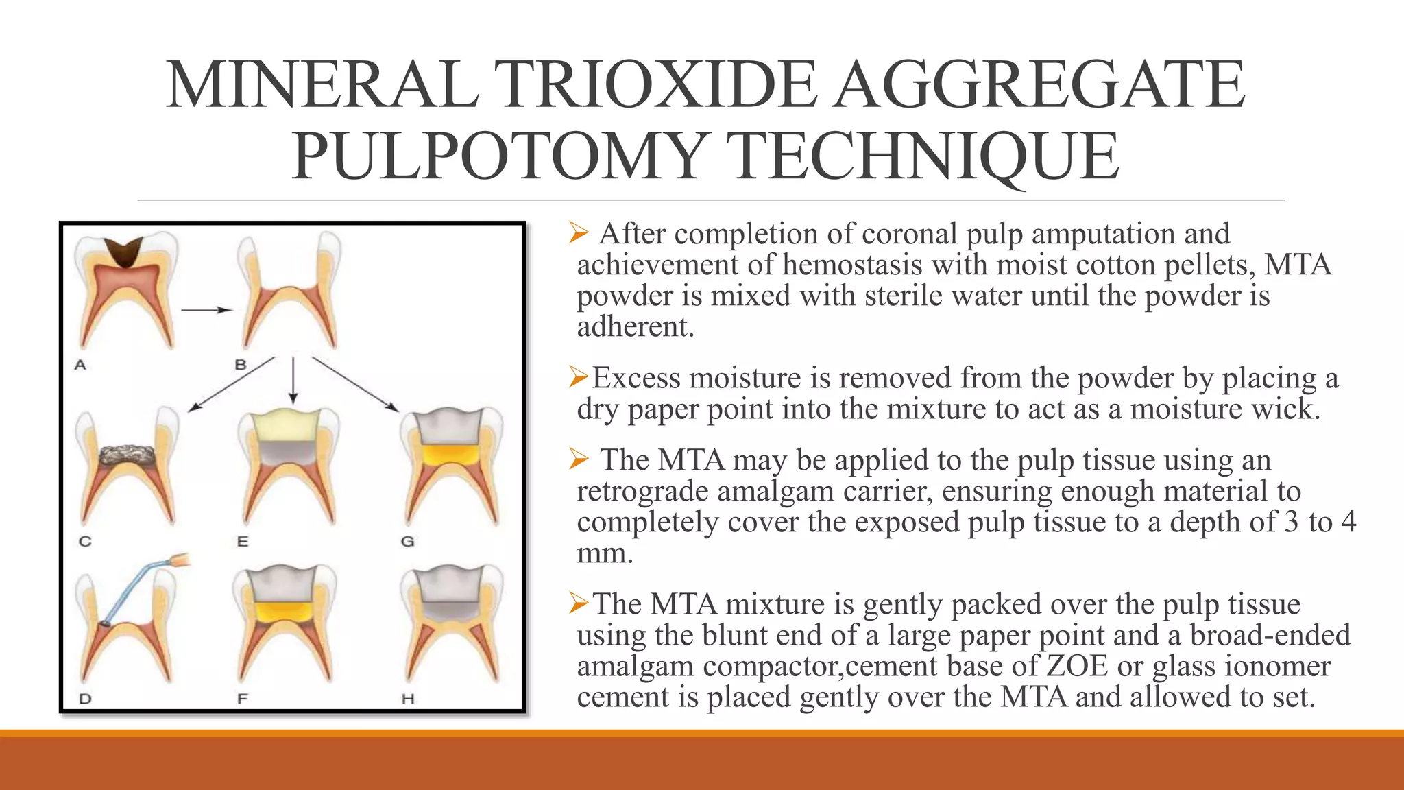 Formocresol controversies | PPTX