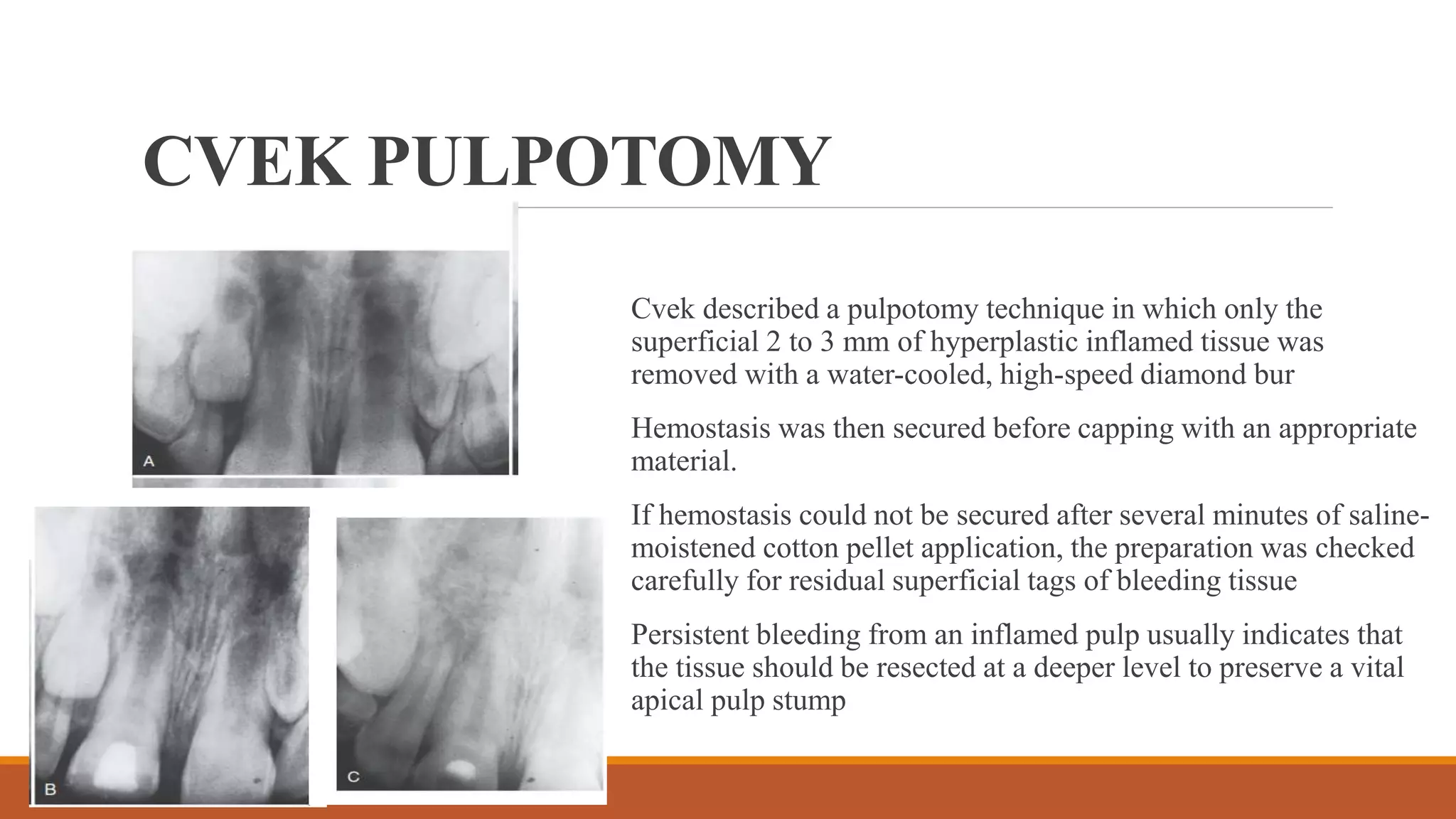 Formocresol controversies | PPTX