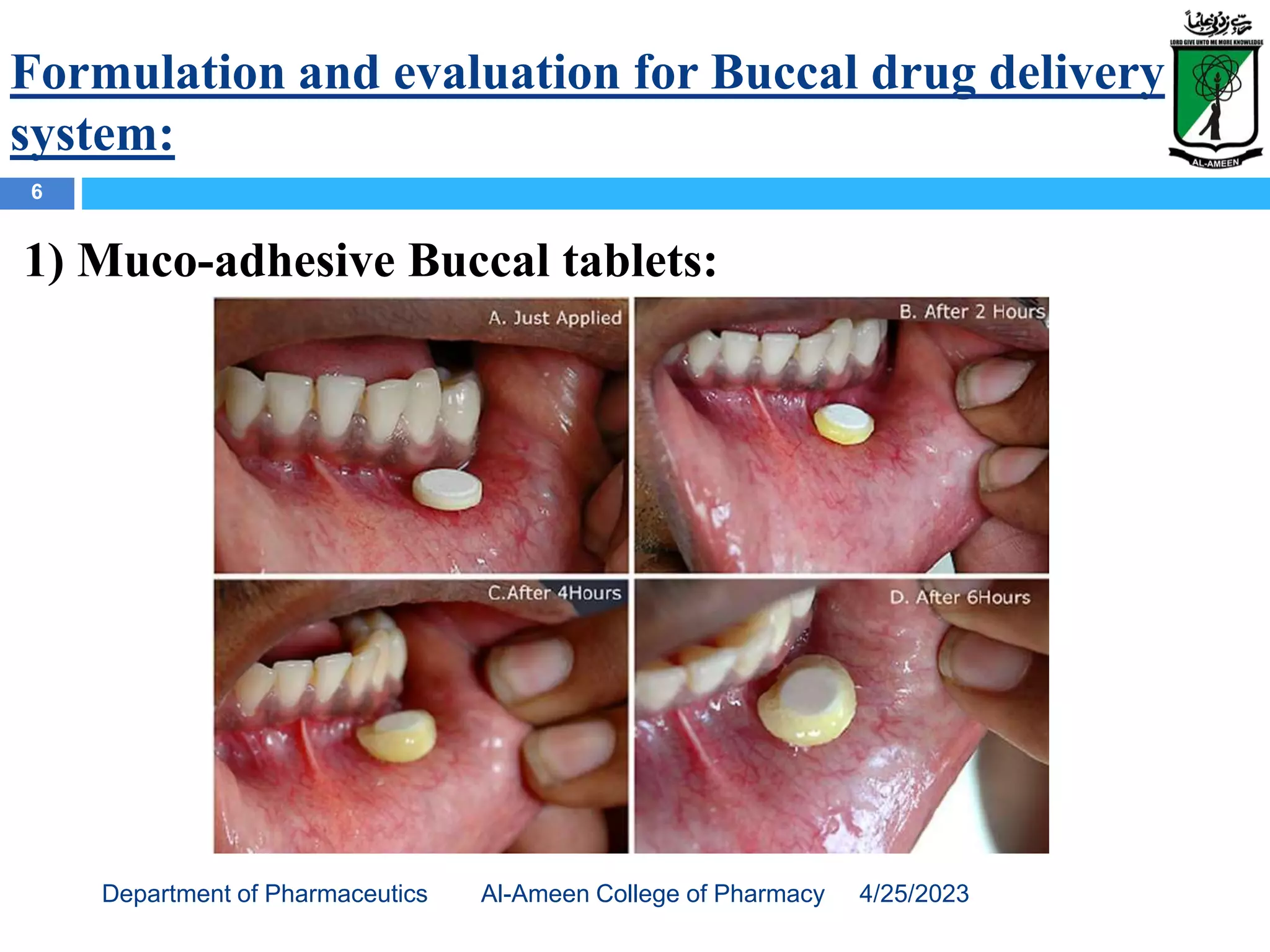Formulation and Evaluation of Buccal Drug delivery system.pptx