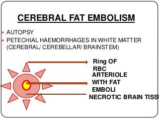 Forensic medicine and embolism | PPTX