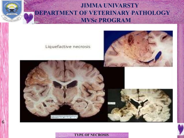 TYPE OF NECROSIS.pptx