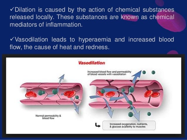 vascular changes in inflamation