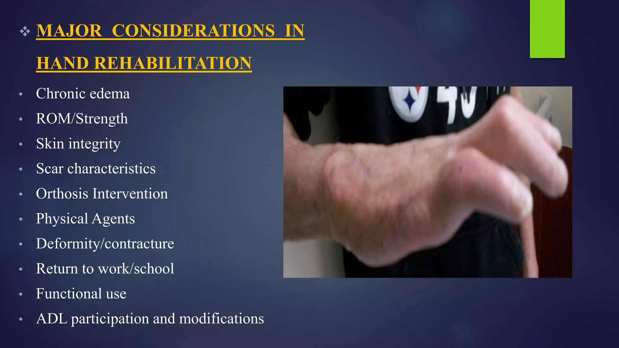 Hand Rehabilitation In Burns | PPTX