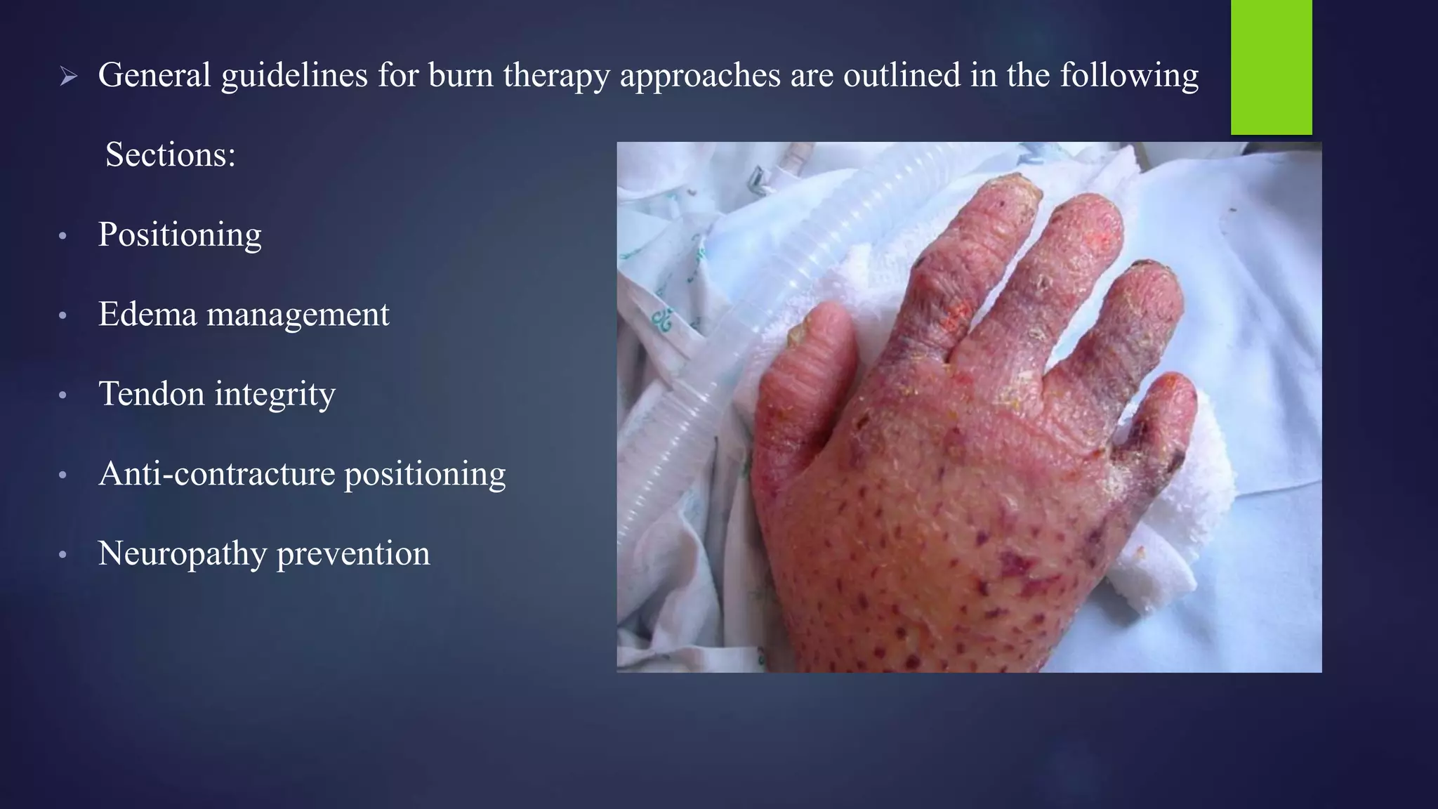 Hand Rehabilitation In Burns | PPTX