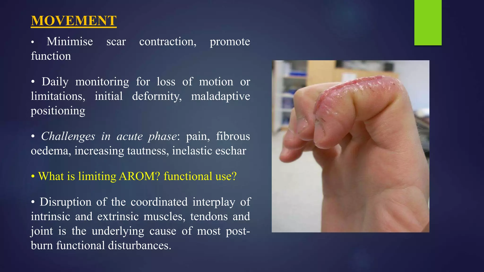 Hand Rehabilitation In Burns | PPTX