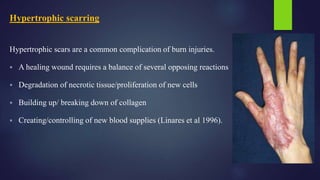 Hand Rehabilitation In Burns | PPTX