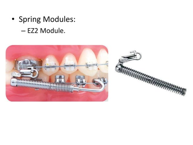 Forsus | PPTX | Dental Health | Diseases and Conditions