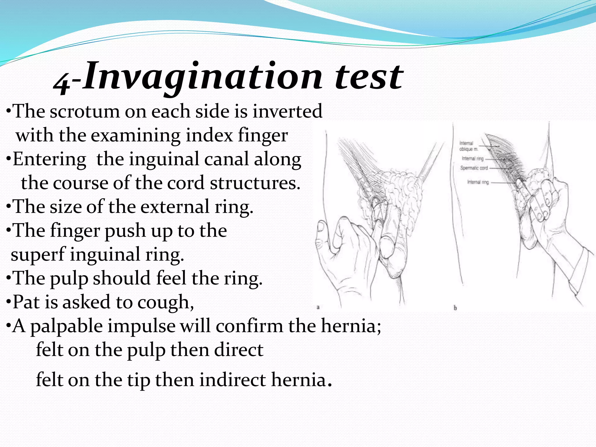 Hernia treatment and surgery | PPTX