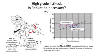 Fortis lecture High Grade Spondylolisthesis | PPT