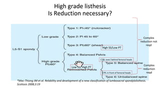 Fortis lecture High Grade Spondylolisthesis | PPT