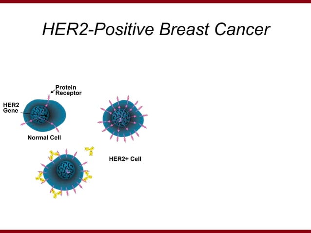 Metastatic Breast Cancer Research And Treatment
