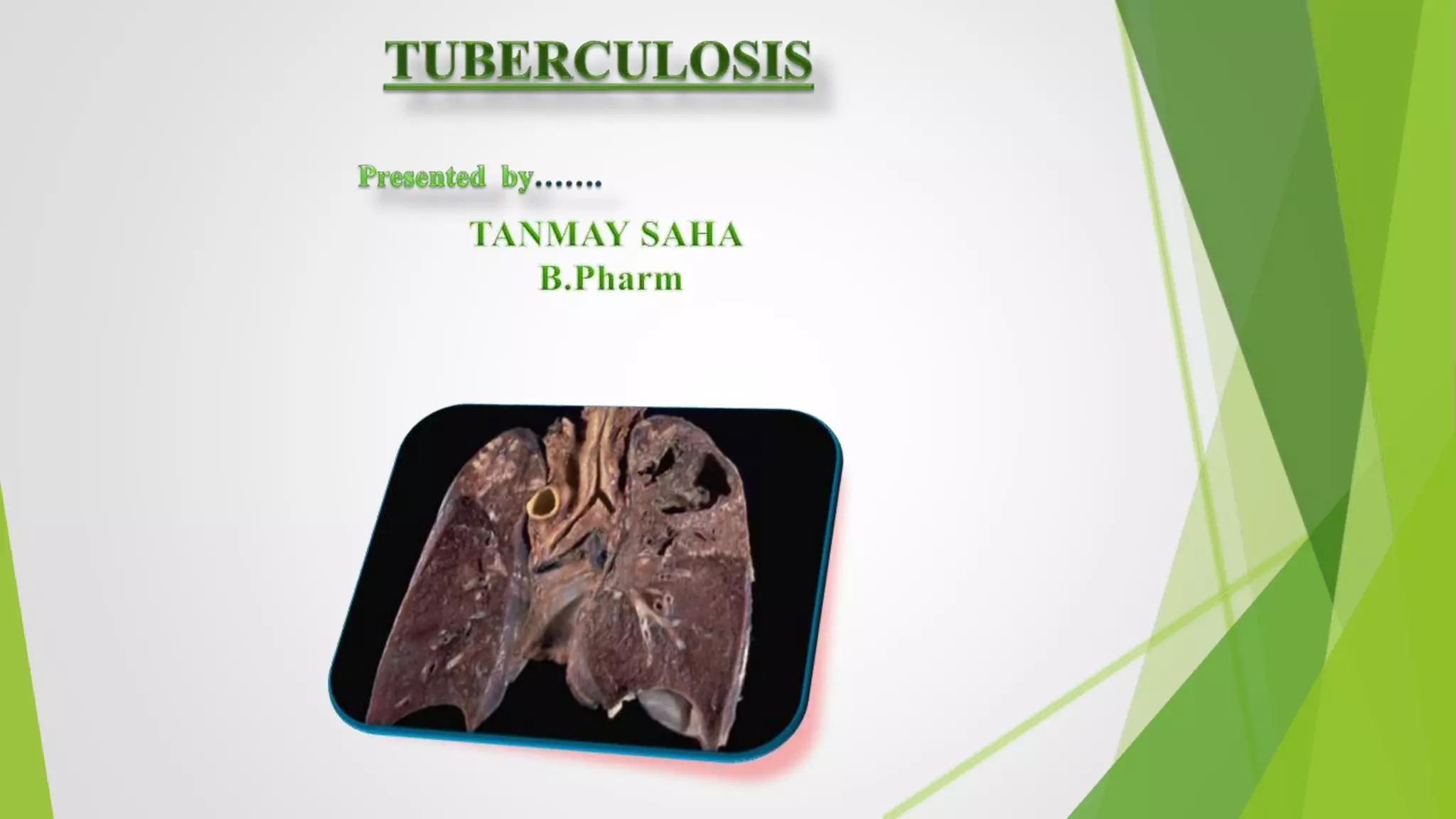 Tuberculosis | PPTX