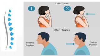Forward head posture-causes | muscle pain symptoms | diagnosis ...