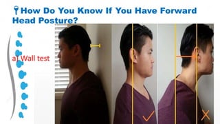 Forward head posture-causes | muscle pain symptoms | diagnosis ...