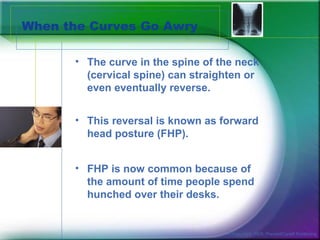 Forward Head Posture Powerpoint | PPT