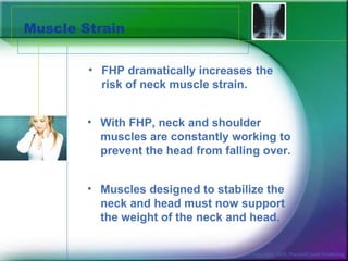 Forward Head Posture Powerpoint | PPT