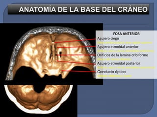 FOSA CRANEAL ANTERIOR | PPTX