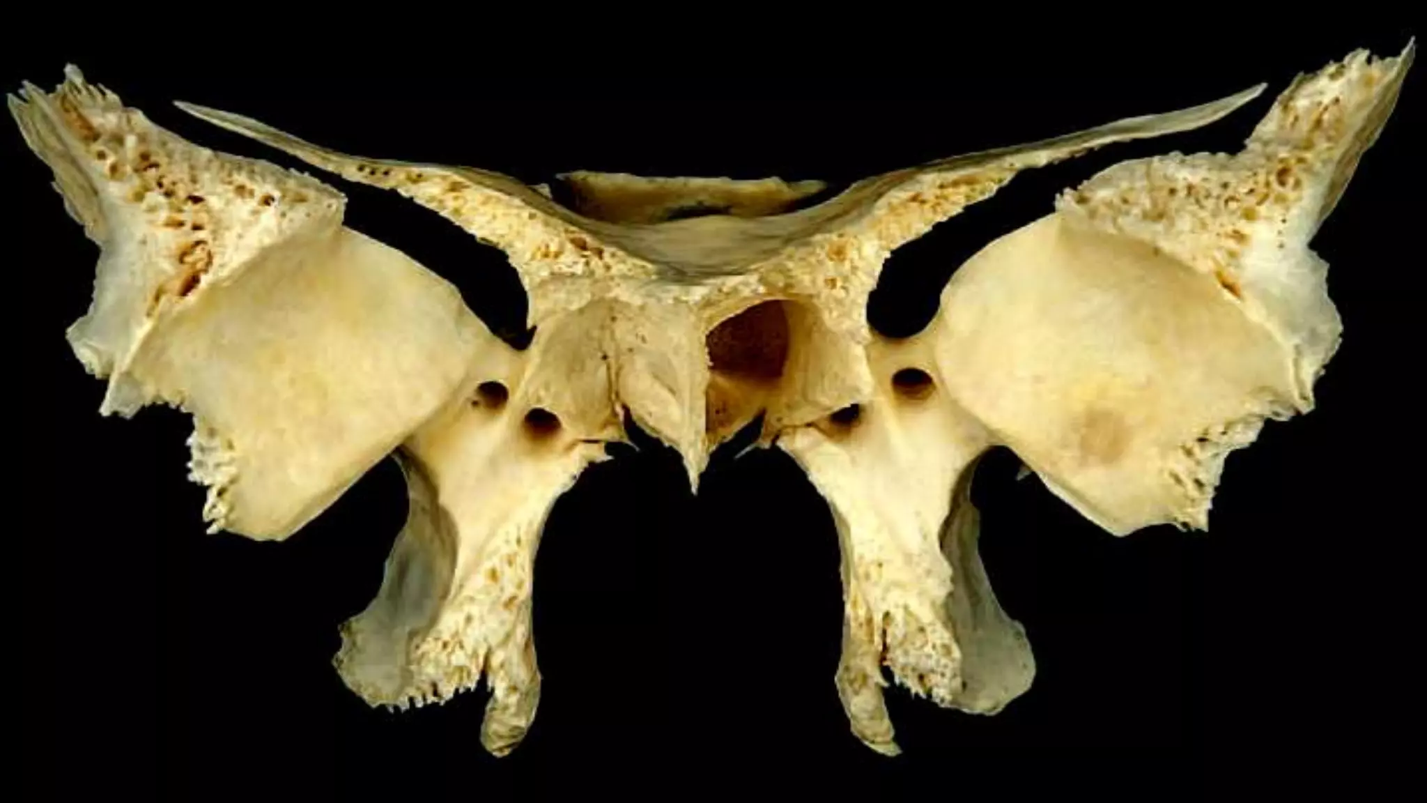 Fosa craneal media | PPTX