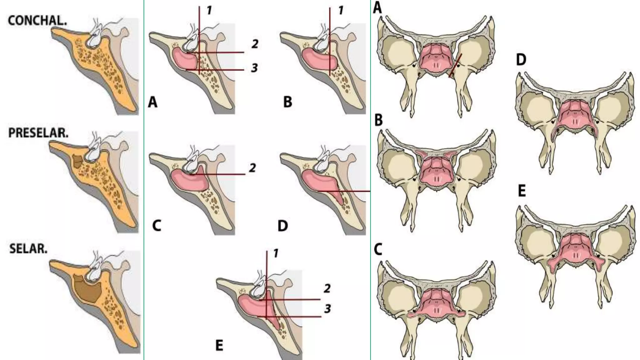 Fosa craneal media | PPTX