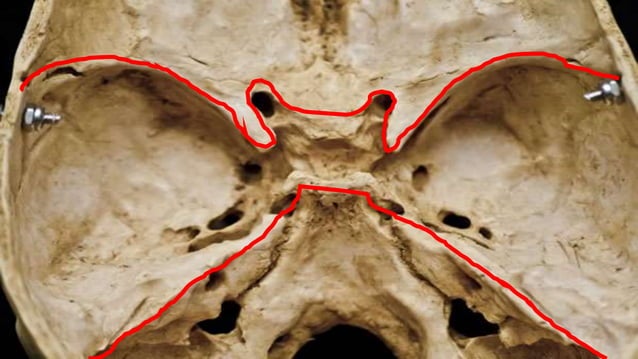 Fosa craneal media | PPT