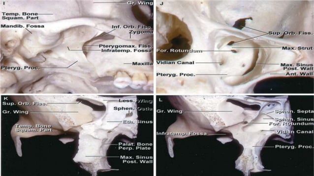Fosa craneal media | PPT