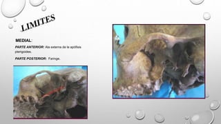 FOSA INFRATEMPORAL: TAMBIEN CONOCIDO COMO fosa cigomática | PPTX