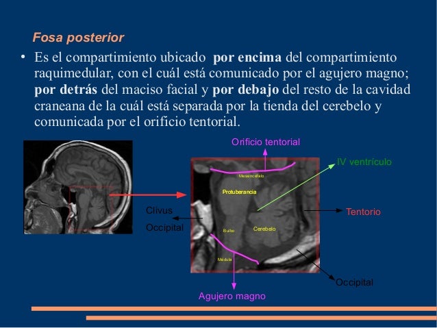 Fosa posterior rmn (1)