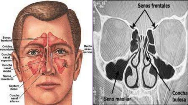 Fosas nasales anatomia | PPTX