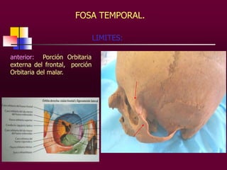 Fosas temporal, cigomatica y pterigopalatina | PDF