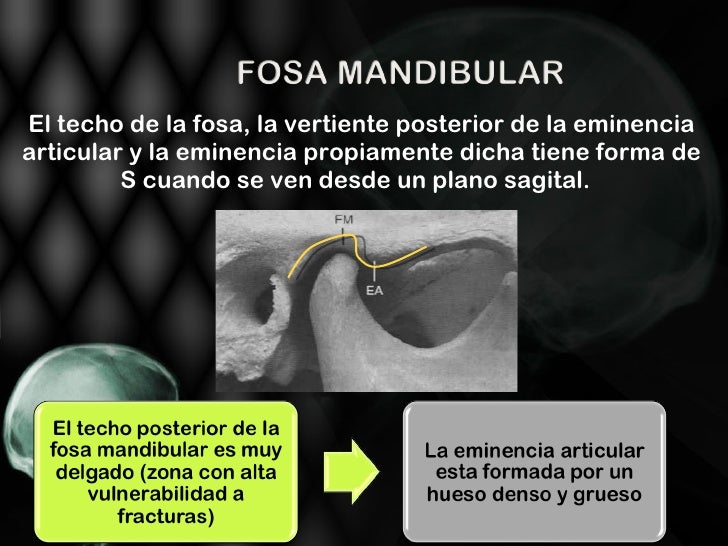 Fosa y eminencia articular