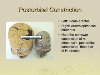 Postorbital Constriction Australopithecus Afarensis